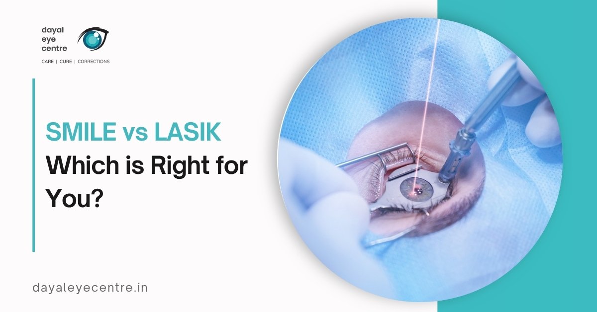 SMILE vs. LASIK: Which Vision Correction Surgery Is Best for You?