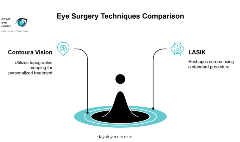 Contoura Vision vs. LASIK: Key Differences & Which is Better?