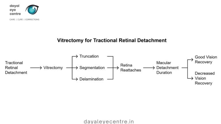 What are the different types of retinal detachment surgery?